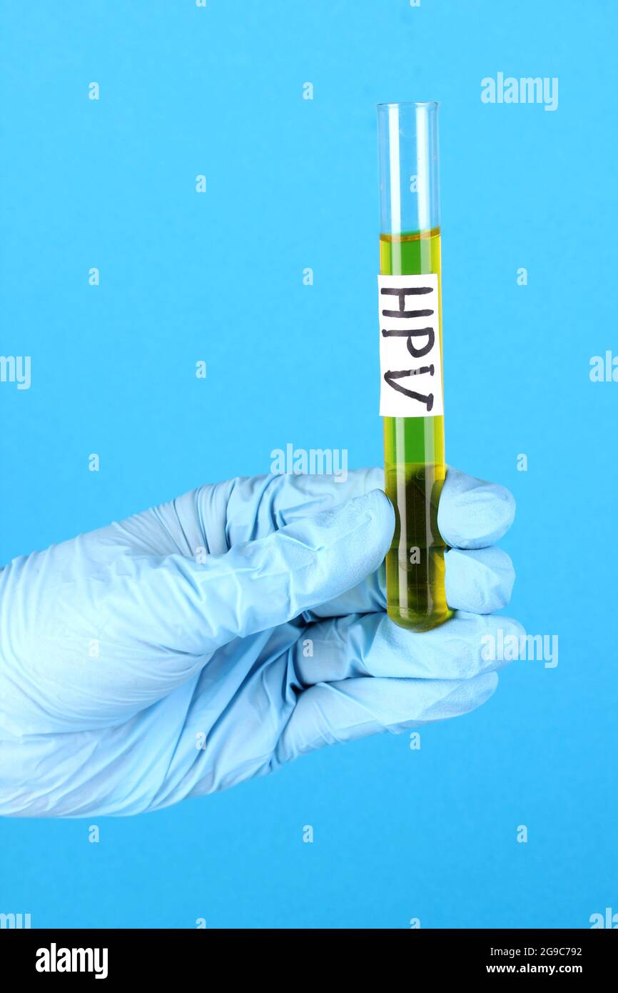 Test tube labeled Human Stock Photo - Alamy
