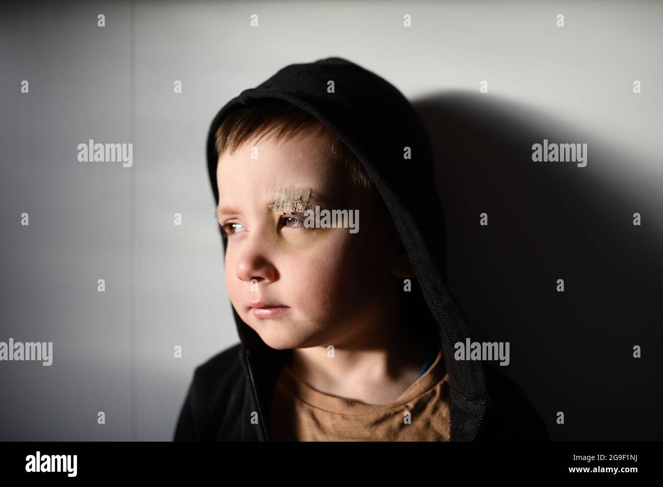 Poor sad small boy with cut eyebrow standing indoors at home, poverty ...