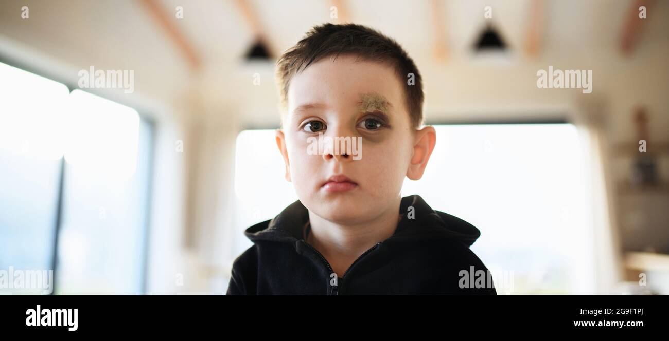 Poor sad small boy with cut eyebrow standing indoors at home, poverty ...