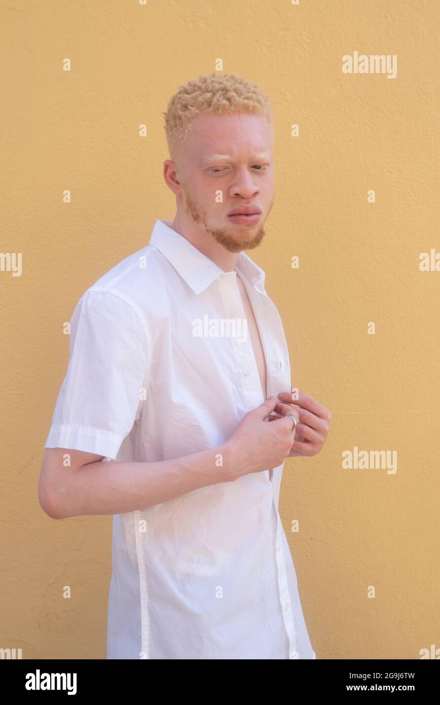 Germany, Cologne, Albino man in white shirt against yellow wall Stock ...