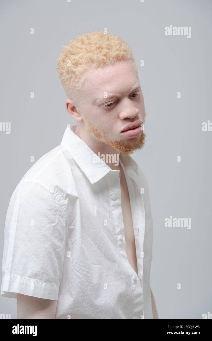 White Albino Man Albino Man Portrait By The Beach Looking At The