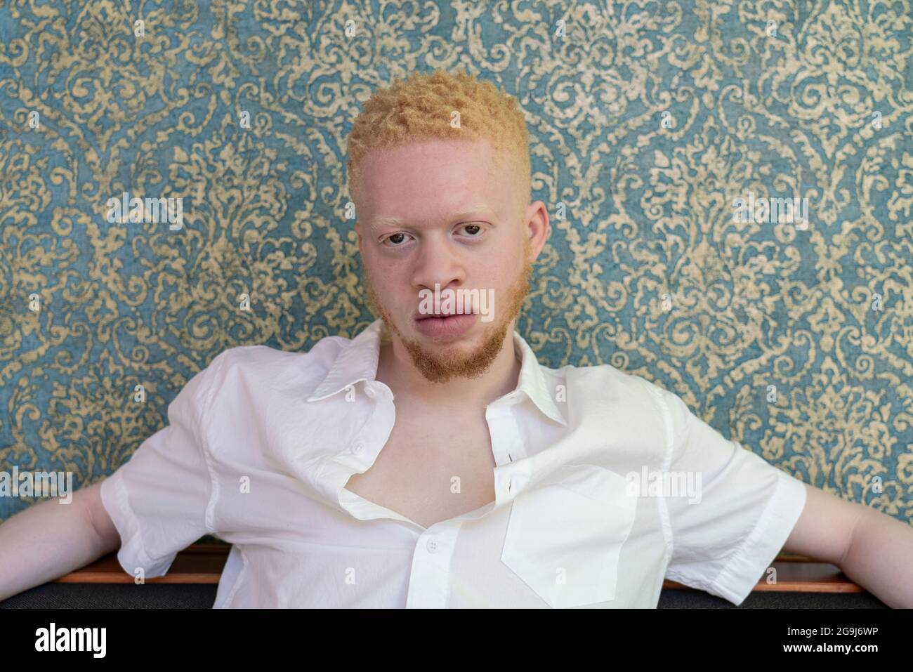Germany, Cologne, Portrait of albino man in white shirt Stock Photo - Alamy