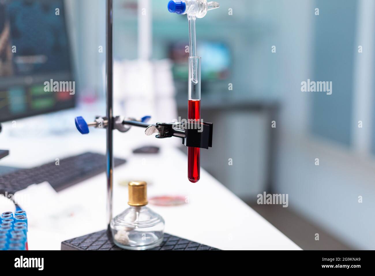 Blood sample ready for biological examination during microbiology ...