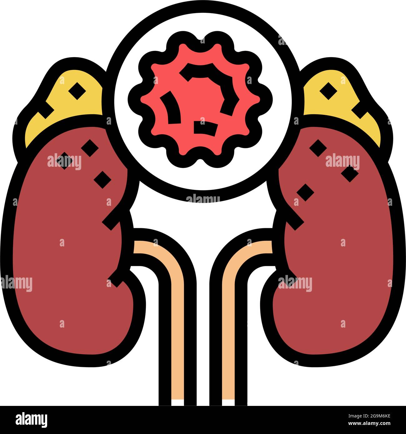 cushing cortisol syndrome color icon vector. cushing cortisol syndrome ...