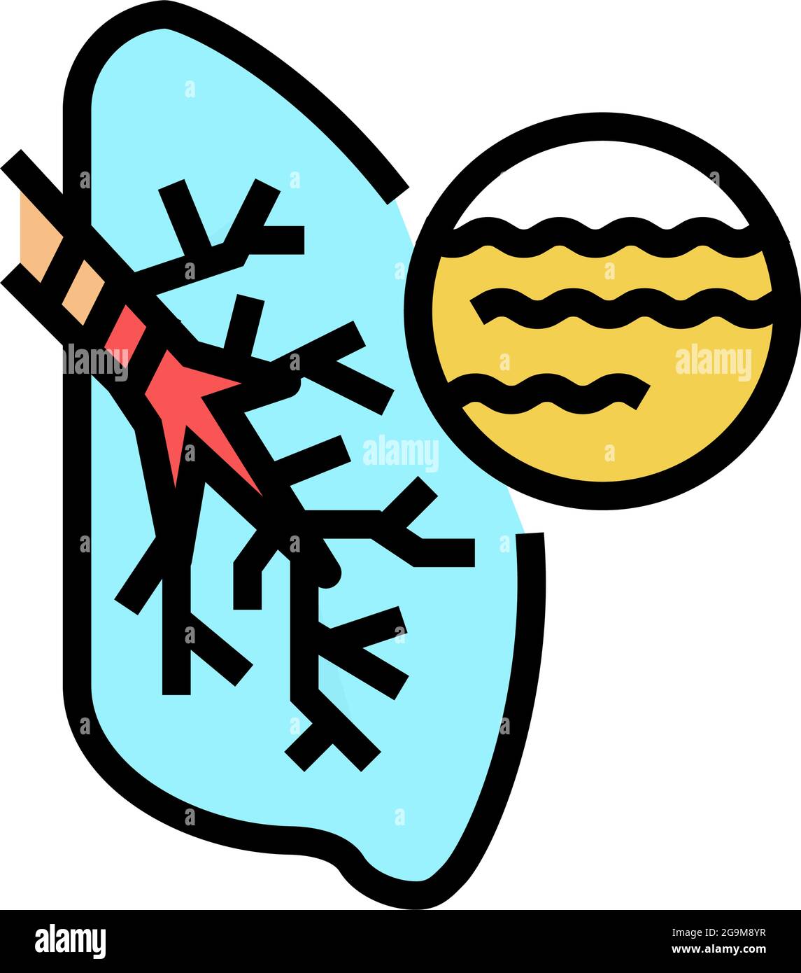 bronchitis disease color icon vector illustration Stock Vector Image ...