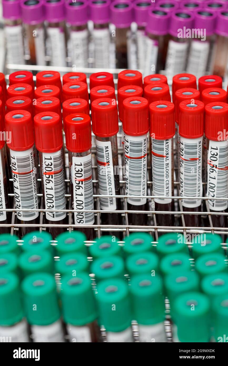 Blood tube for testing in lab¹ratory Stock Photo - Alamy