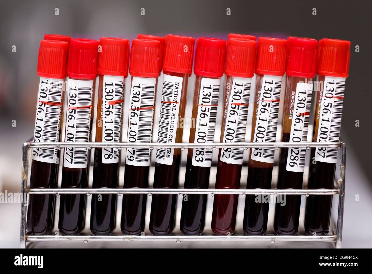 Blood tube for testing in lab¹ratory Stock Photo - Alamy