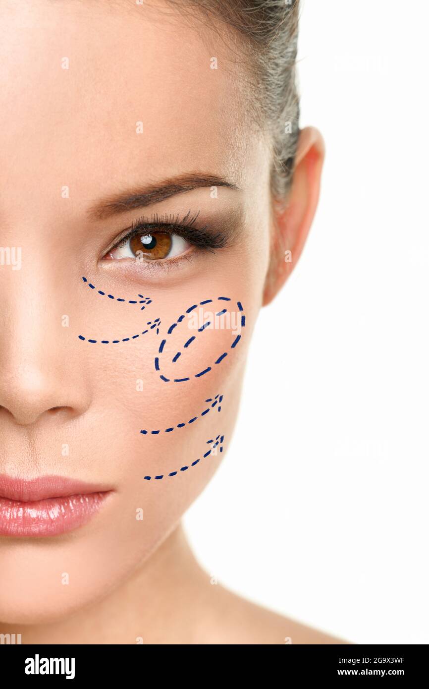 Plastic surgery Asian woman cheekbone augmentation surgical beauty ...