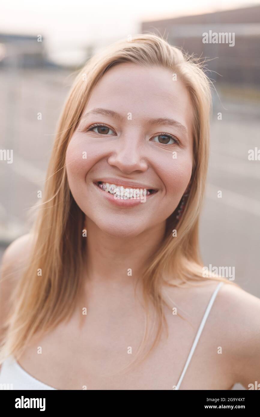 Overbite smile smiling hi-res stock photography and images - Alamy