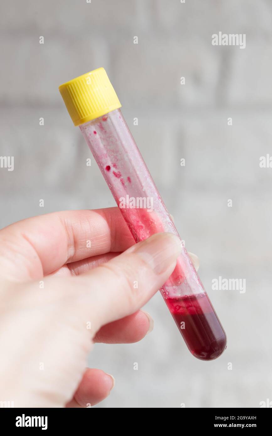 Hand holding a test tube with a blood sample Stock Photo - Alamy