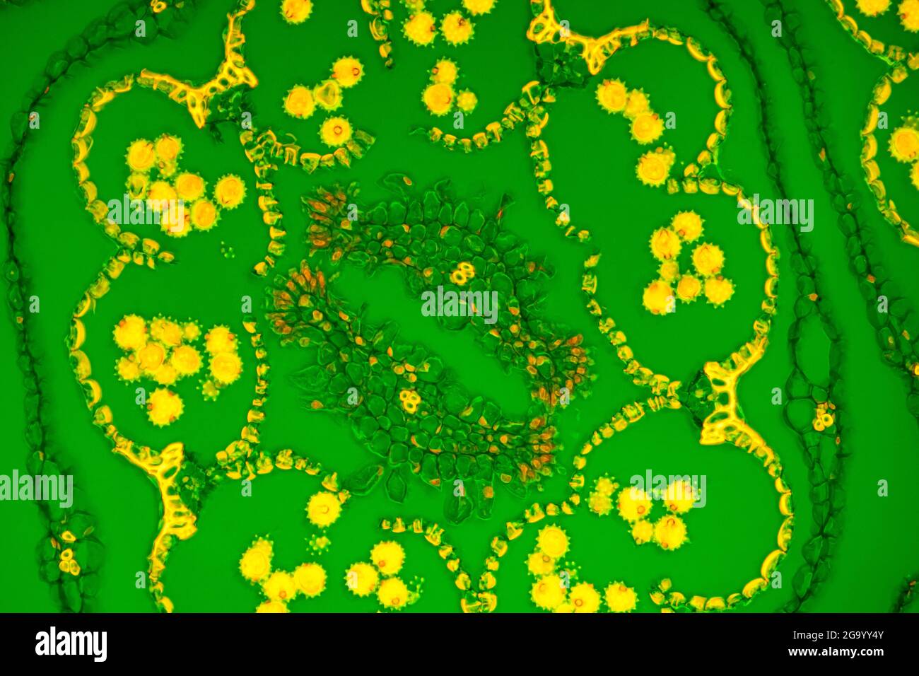 common daisy, lawn daisy, English daisy (Bellis perennis), cross ...