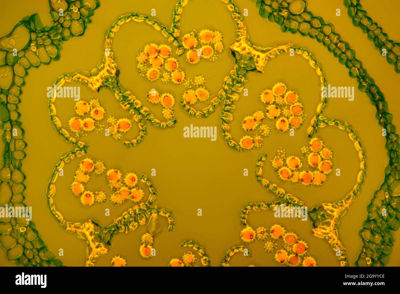 common daisy, lawn daisy, English daisy (Bellis perennis), cross ...