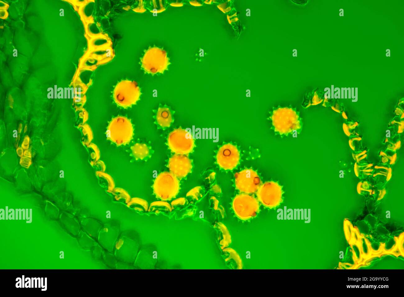common daisy, lawn daisy, English daisy (Bellis perennis), cross ...