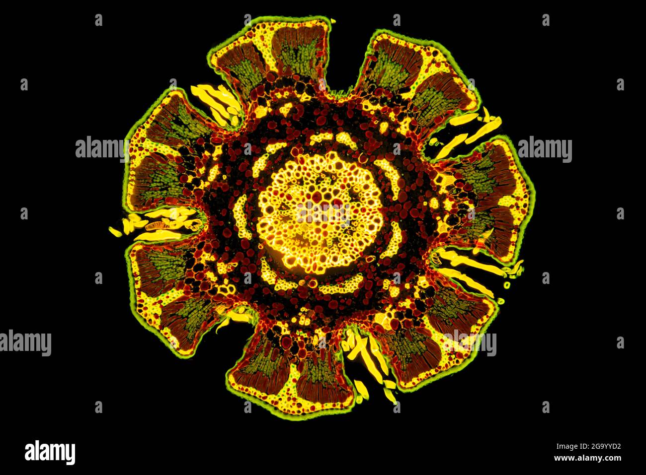 she-oak (Casuarina), cross section through the stem, phase-contrast MRI ...