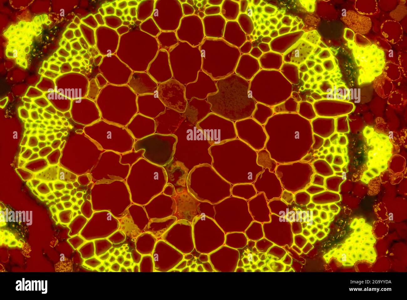 she-oak (Casuarina), cross section through the stem, phase-contrast MRI ...