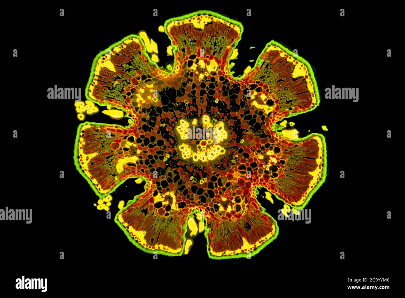 she-oak (Casuarina), cross section through the stem, phase-contrast MRI ...