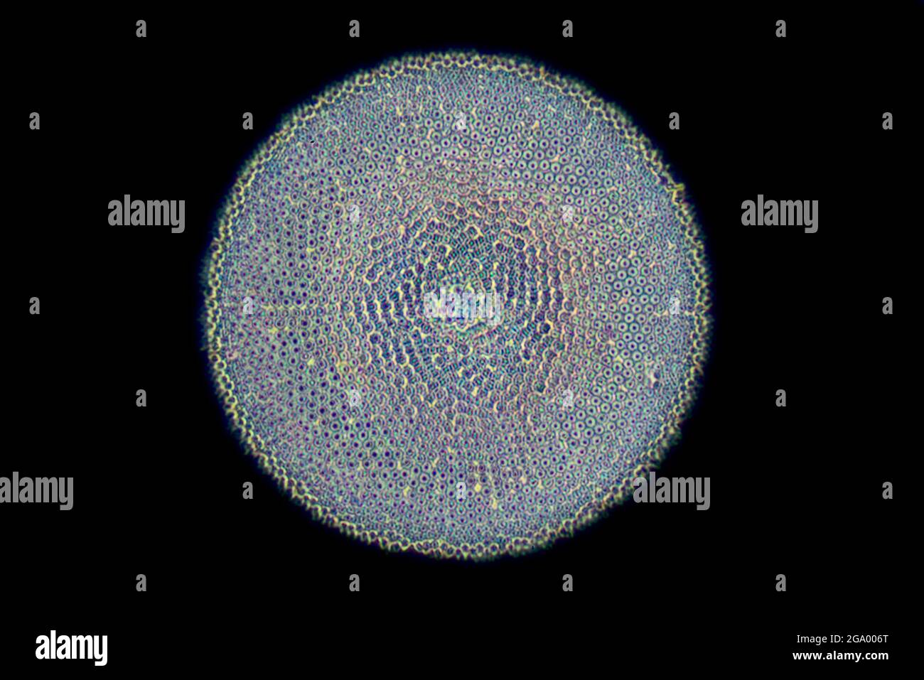 diatom (Diatomeae), MR image of a diatom, magnification x430 related to ...