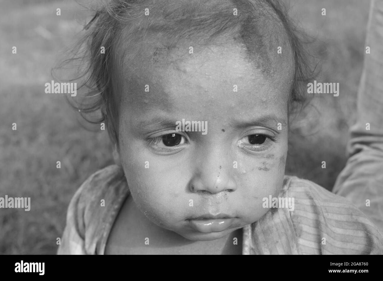 INDIA, DELHI - february 08, 2015: Closeup Of Poor Indian Kid Stock ...