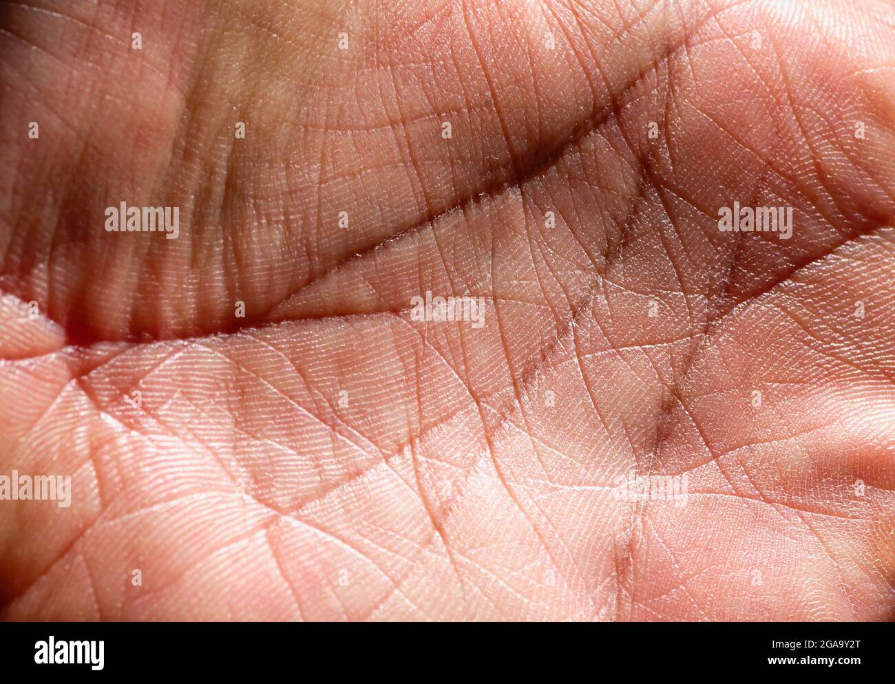 Close up of skin lines on the palms, in shallow focus Stock Photo - Alamy