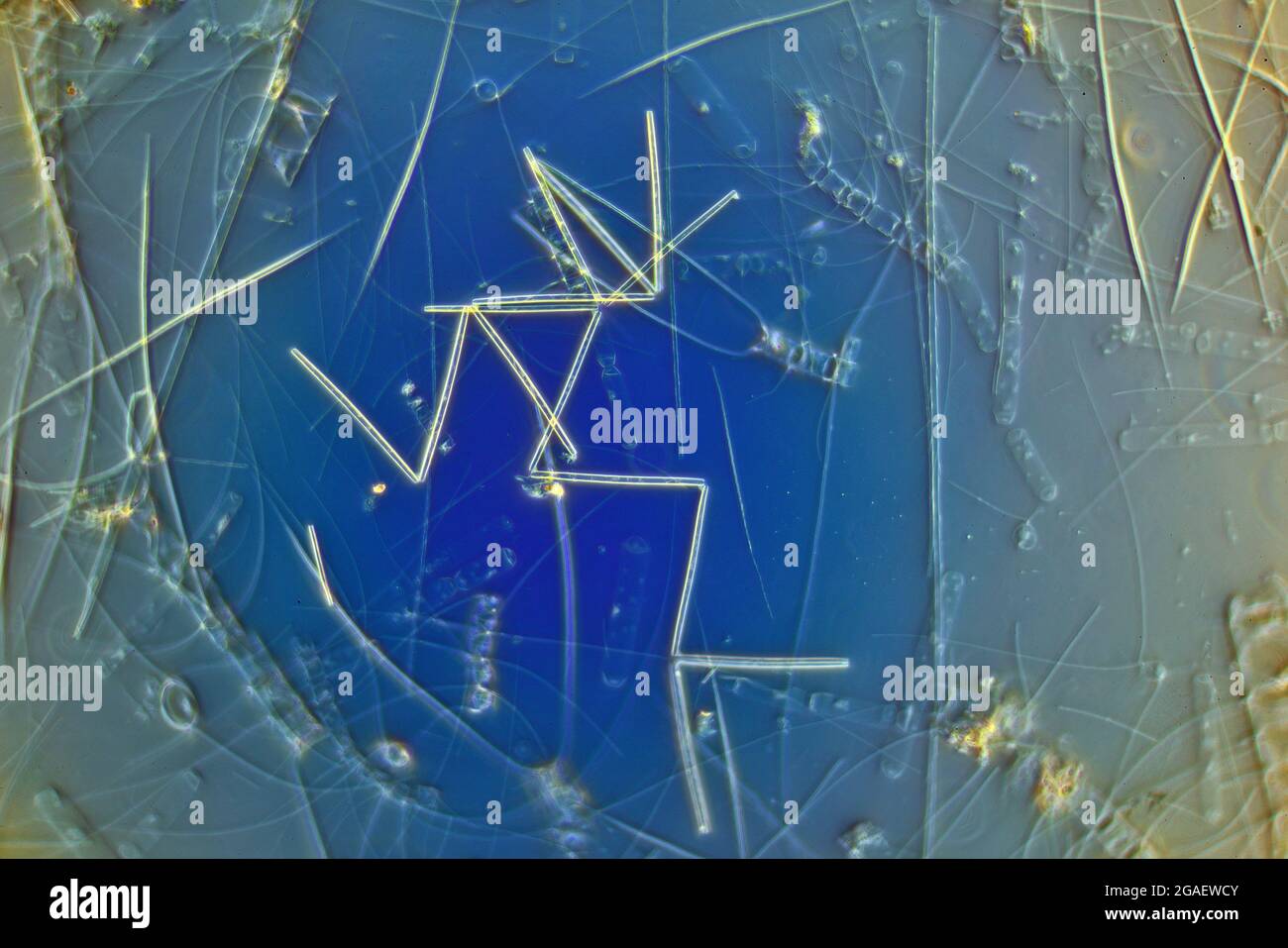 Marine Phytoplankton, Bacteriastrum, diatoms/plankton from the Gullman ...
