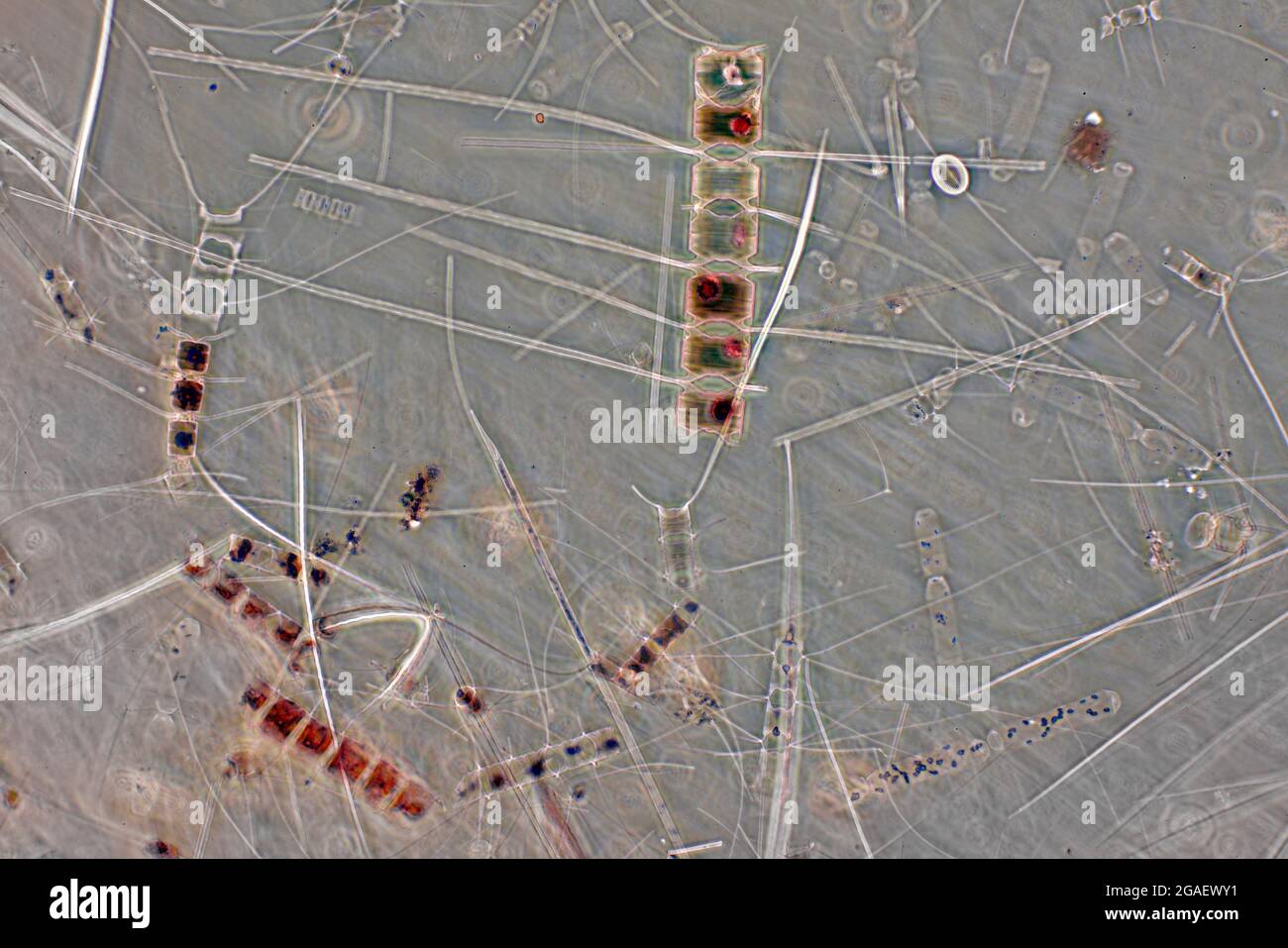 Marine Phytoplankton, Bacteriastrum, diatoms/plankton from the Gullman ...