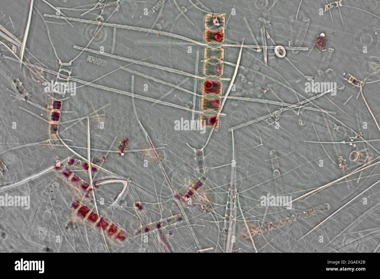 Marine Phytoplankton, Bacteriastrum, diatoms/plankton from the Gullman ...