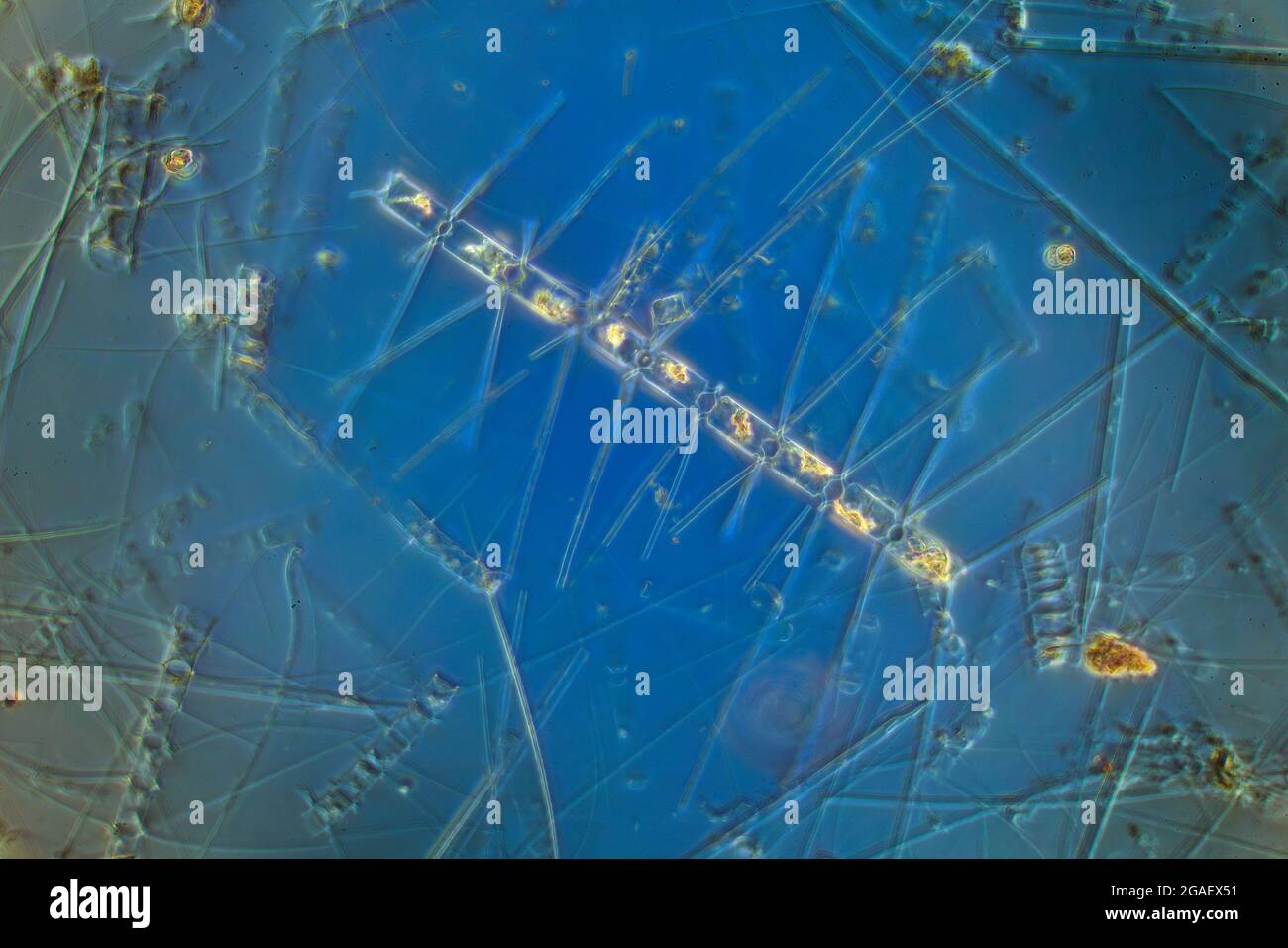 Marine Phytoplankton, Bacteriastrum, diatoms/plankton from the Gullman ...
