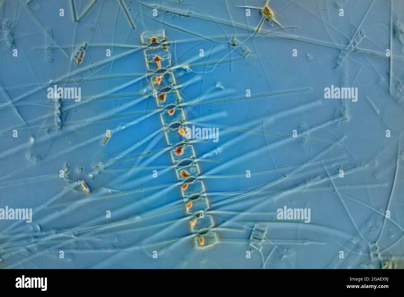 Marine Phytoplankton, Bacteriastrum, diatoms/plankton from the Gullman ...