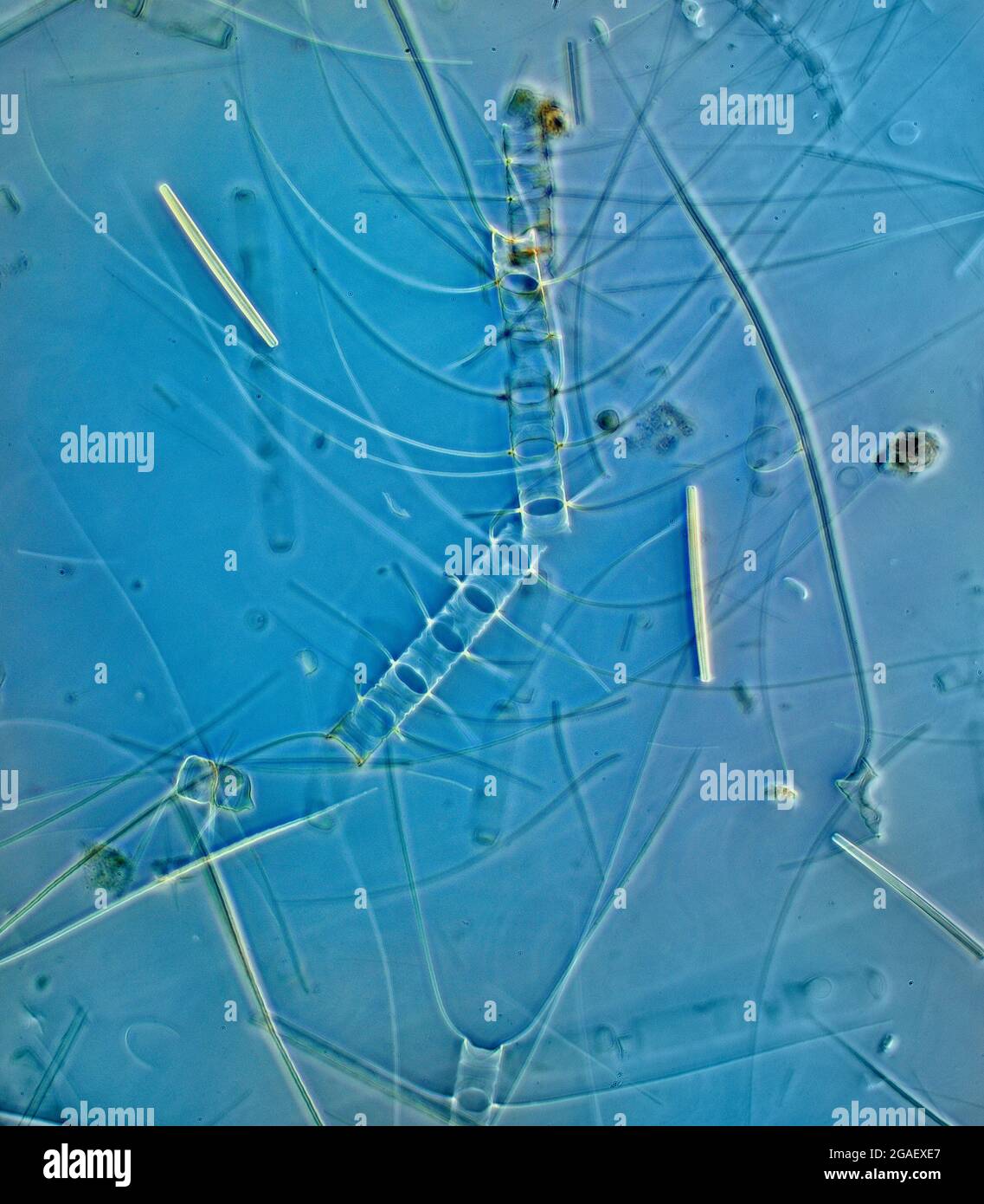 Marine Phytoplankton, Bacteriastrum, diatoms/plankton from the Gullman ...