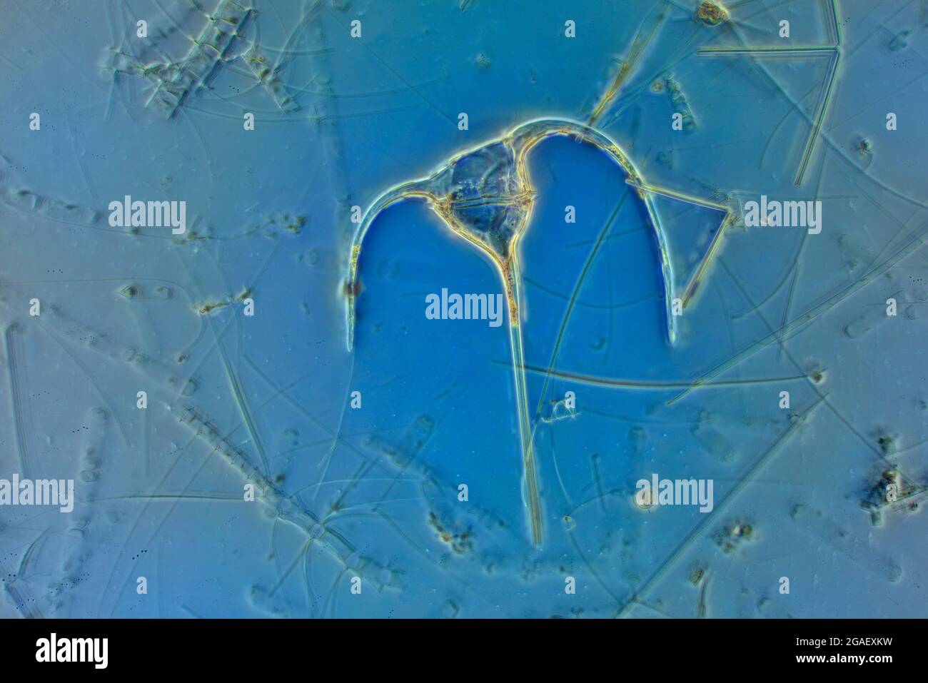 Dinoflagellate hi-res stock photography and images - Alamy