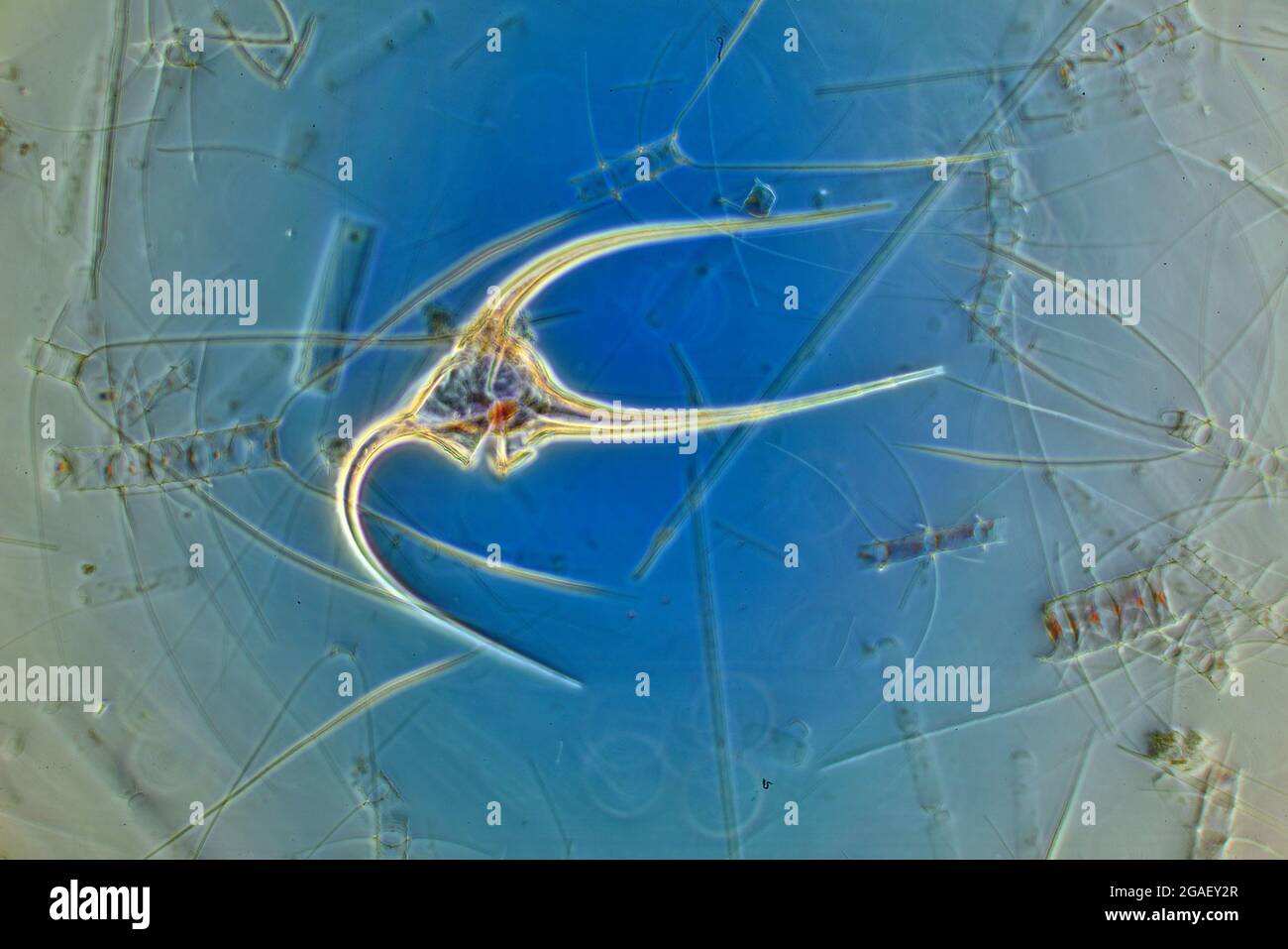 Marine Phytoplankton, dinoflagellate, Bacteriastrum, ceratium, diatoms ...