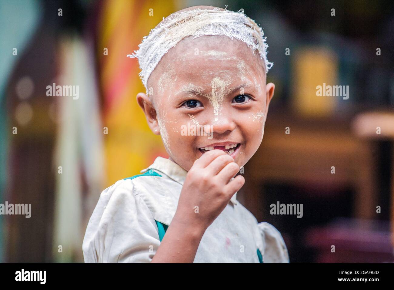 Cute young Burmese child with missing front teeth, wearing thanaka face ...