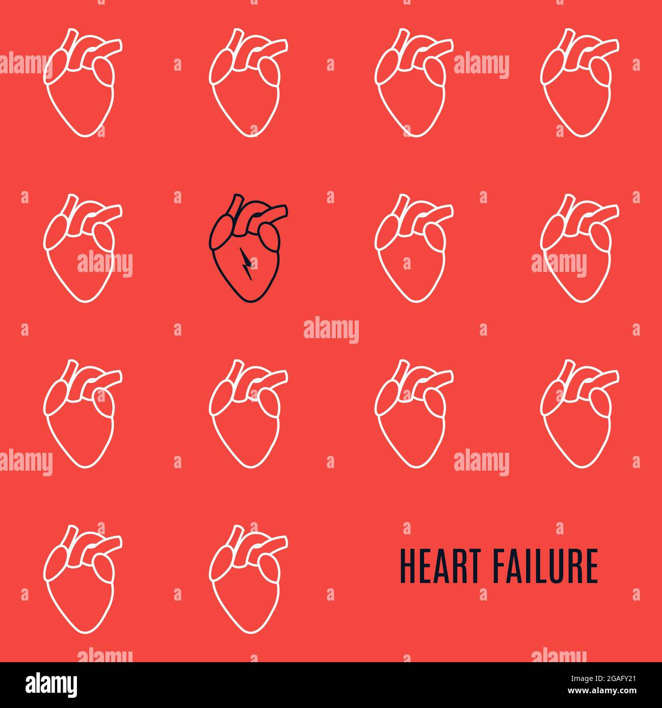 Heart failure, conceptual illustration Stock Photo - Alamy