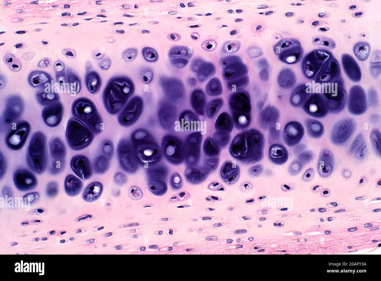 Cartilage micrograph hi-res stock photography and images - Alamy