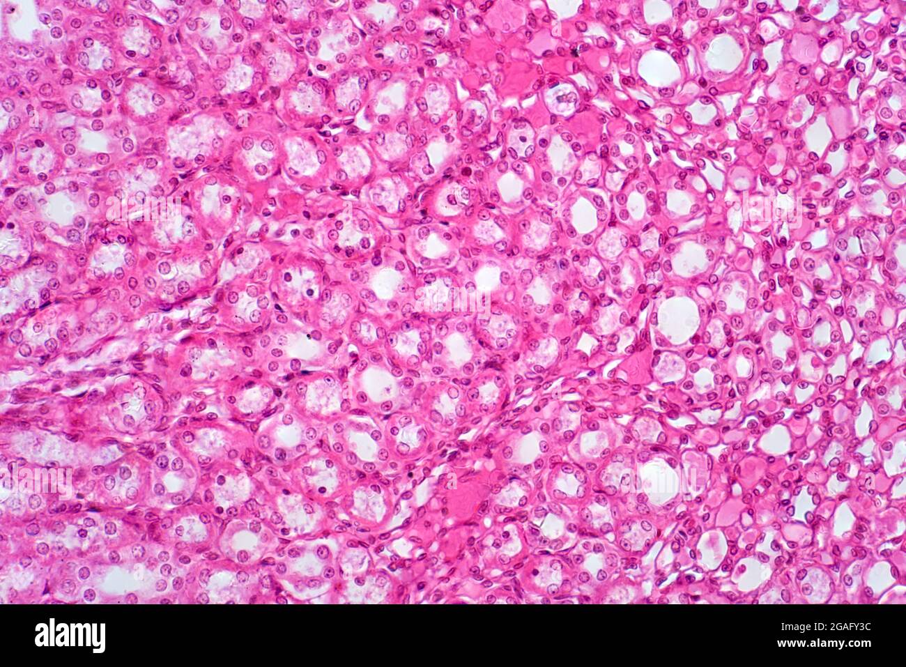 Human kidney tissue, light micrograph Stock Photo - Alamy