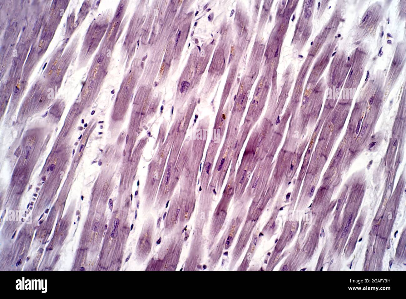 Cardiac Muscle Under Microscope