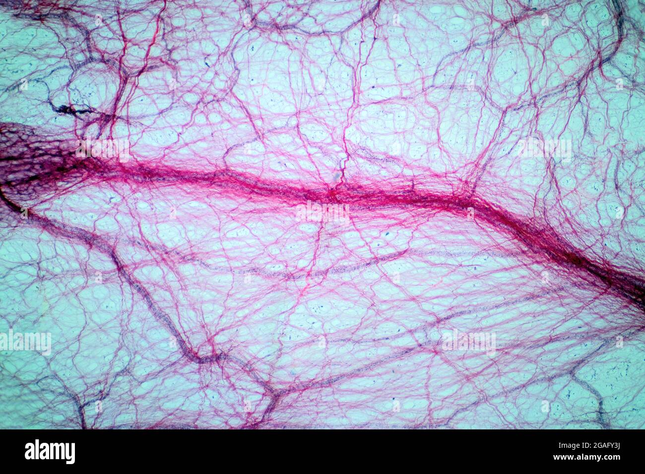 Areolar tissue hi-res stock photography and images - Alamy