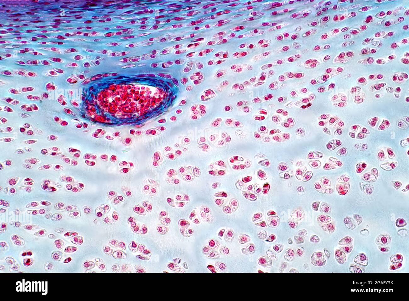 Hyaline cartilage, light micrograph Stock Photo - Alamy