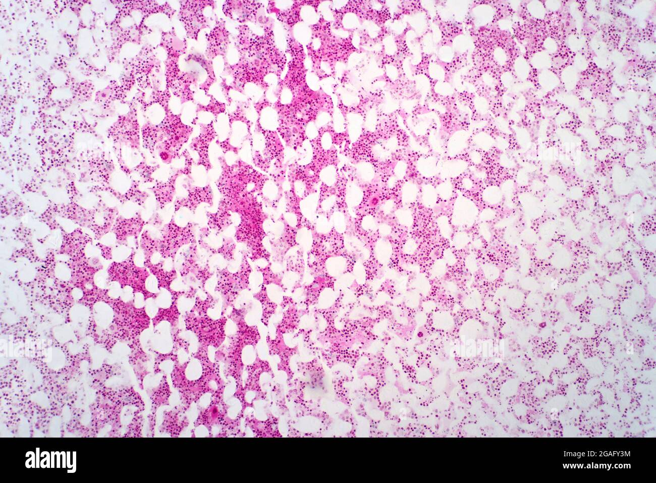 Human bone marrow, light micrograph Stock Photo - Alamy