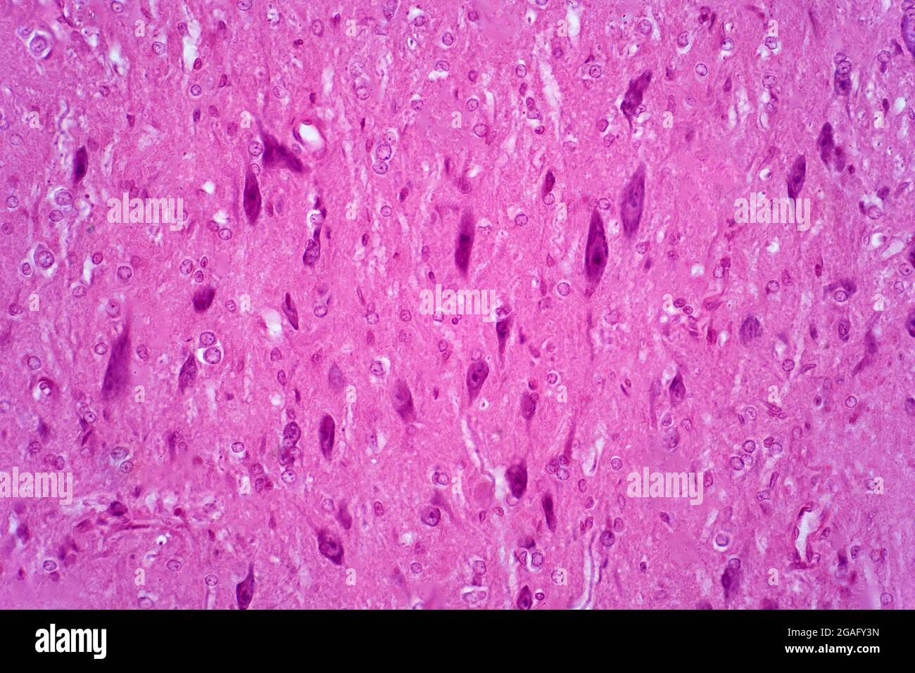 Motor neurons, light micrograph Stock Photo - Alamy