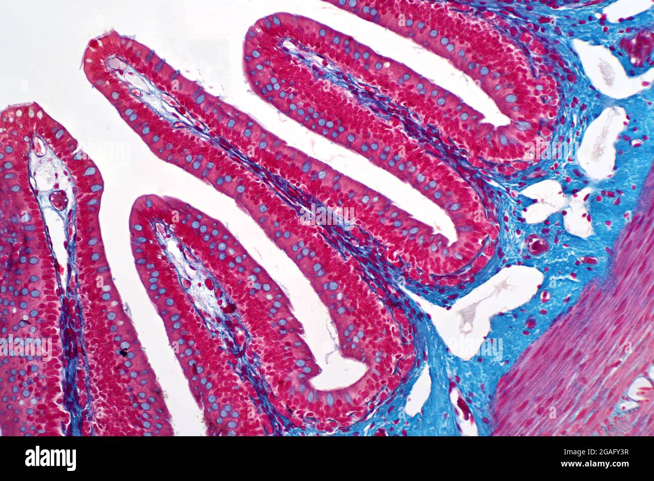 Colon biopsy, light micrograph Stock Photo - Alamy