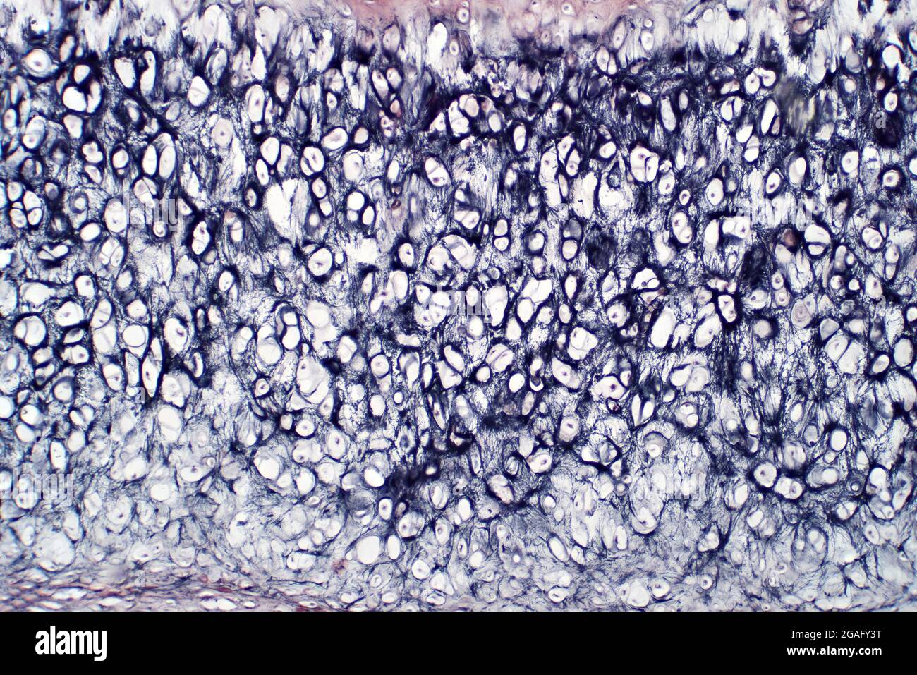 Cross section of human cartilage and bone, light micrograph Stock Photo ...