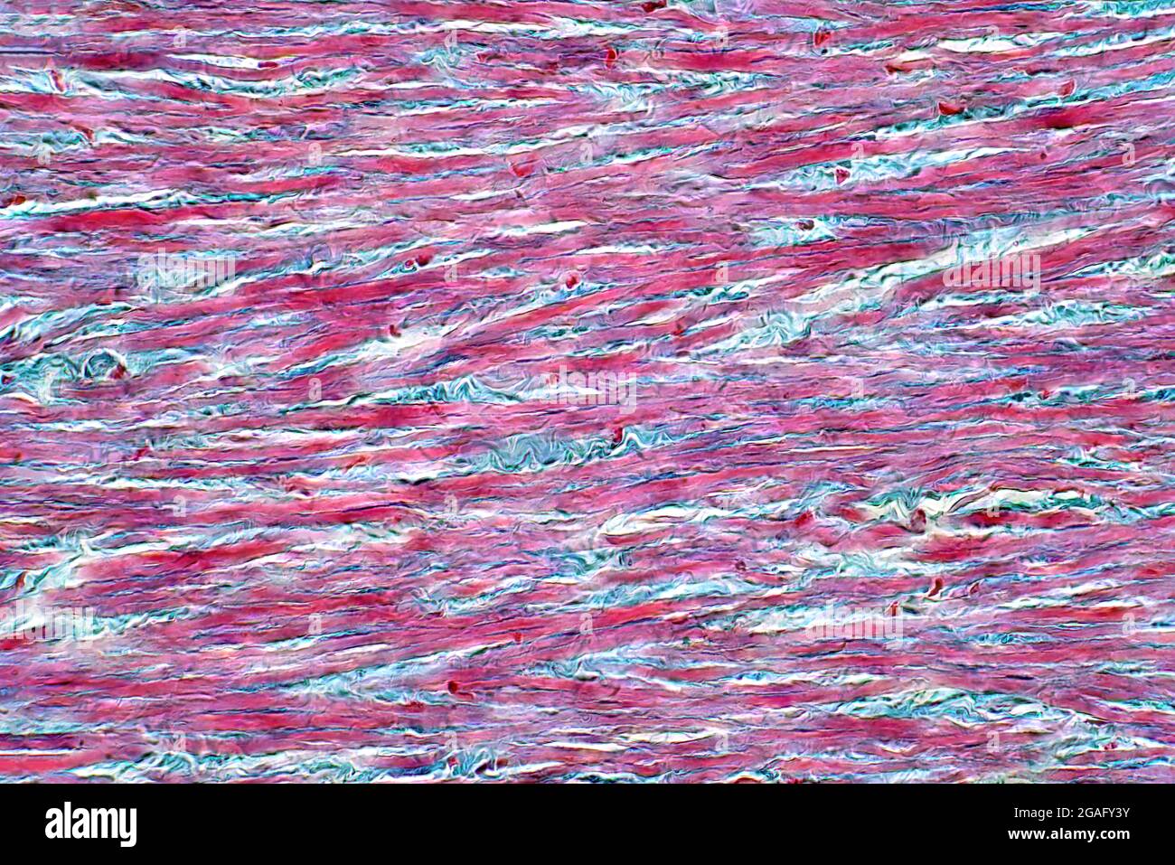 Tendon tissue hi-res stock photography and images - Alamy