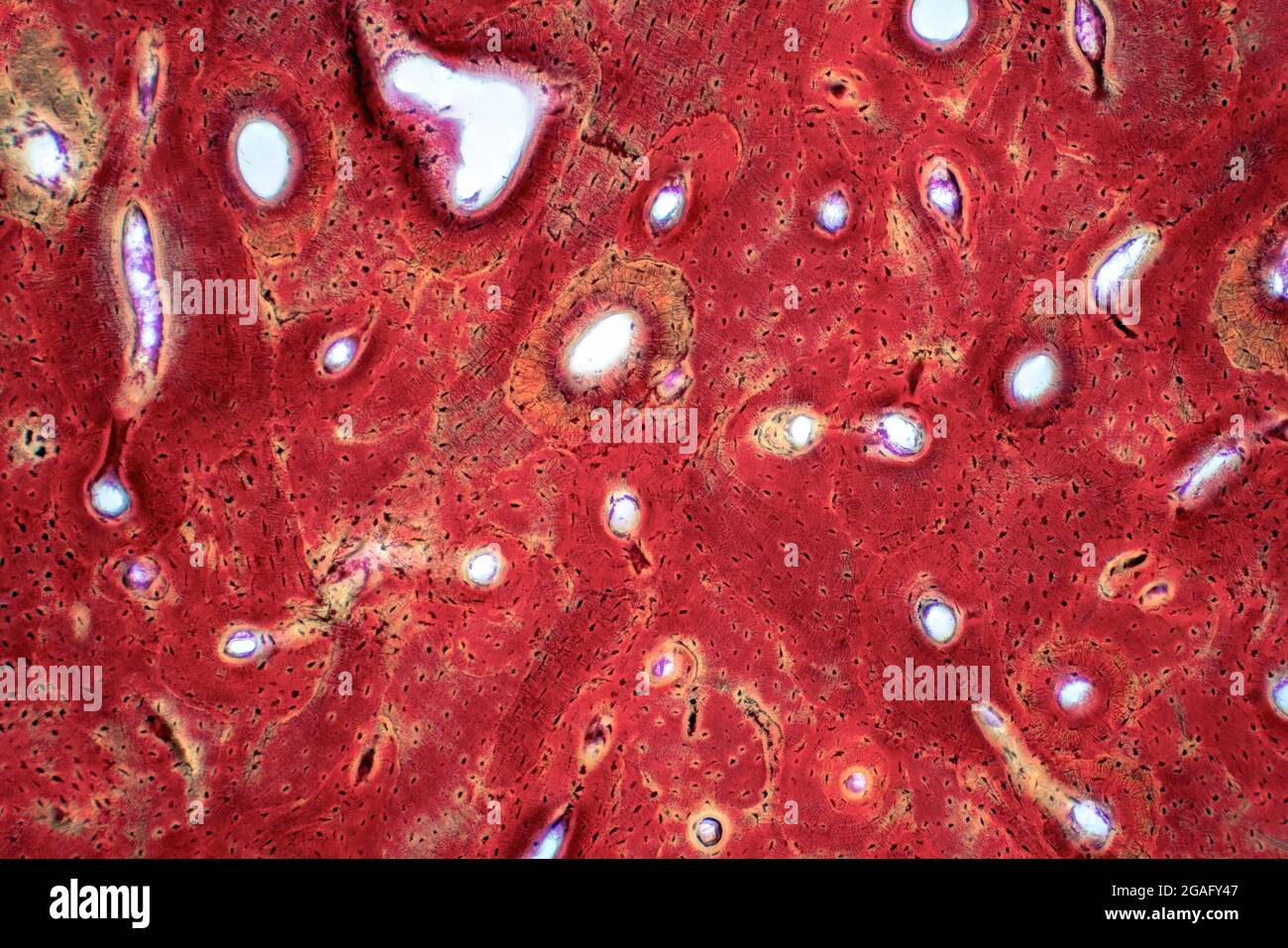 Human compact bone tissue, light micrograph Stock Photo - Alamy