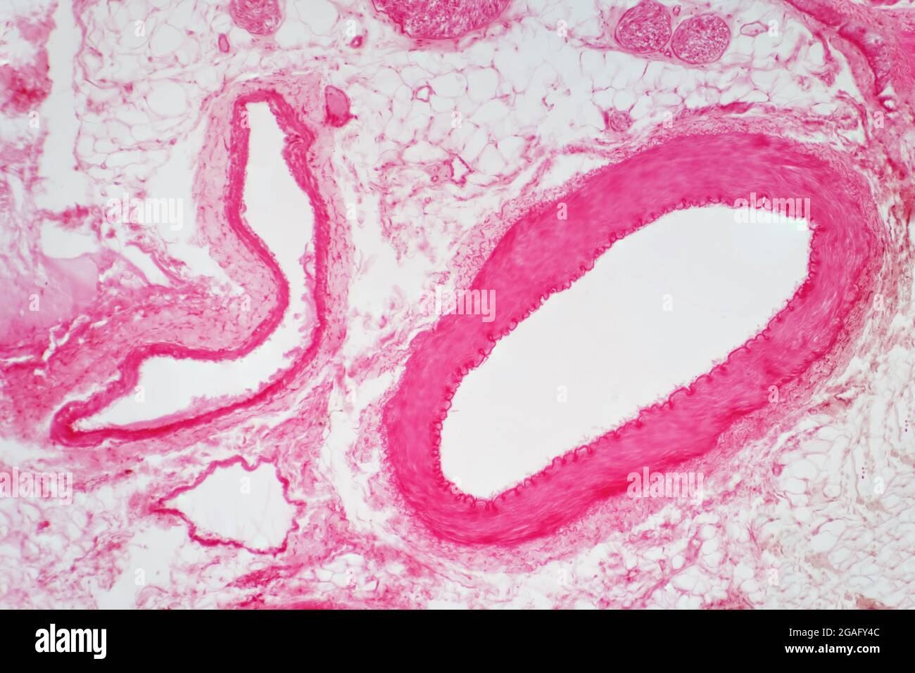 Artery vascular cross section, light micrograph Stock Photo - Alamy