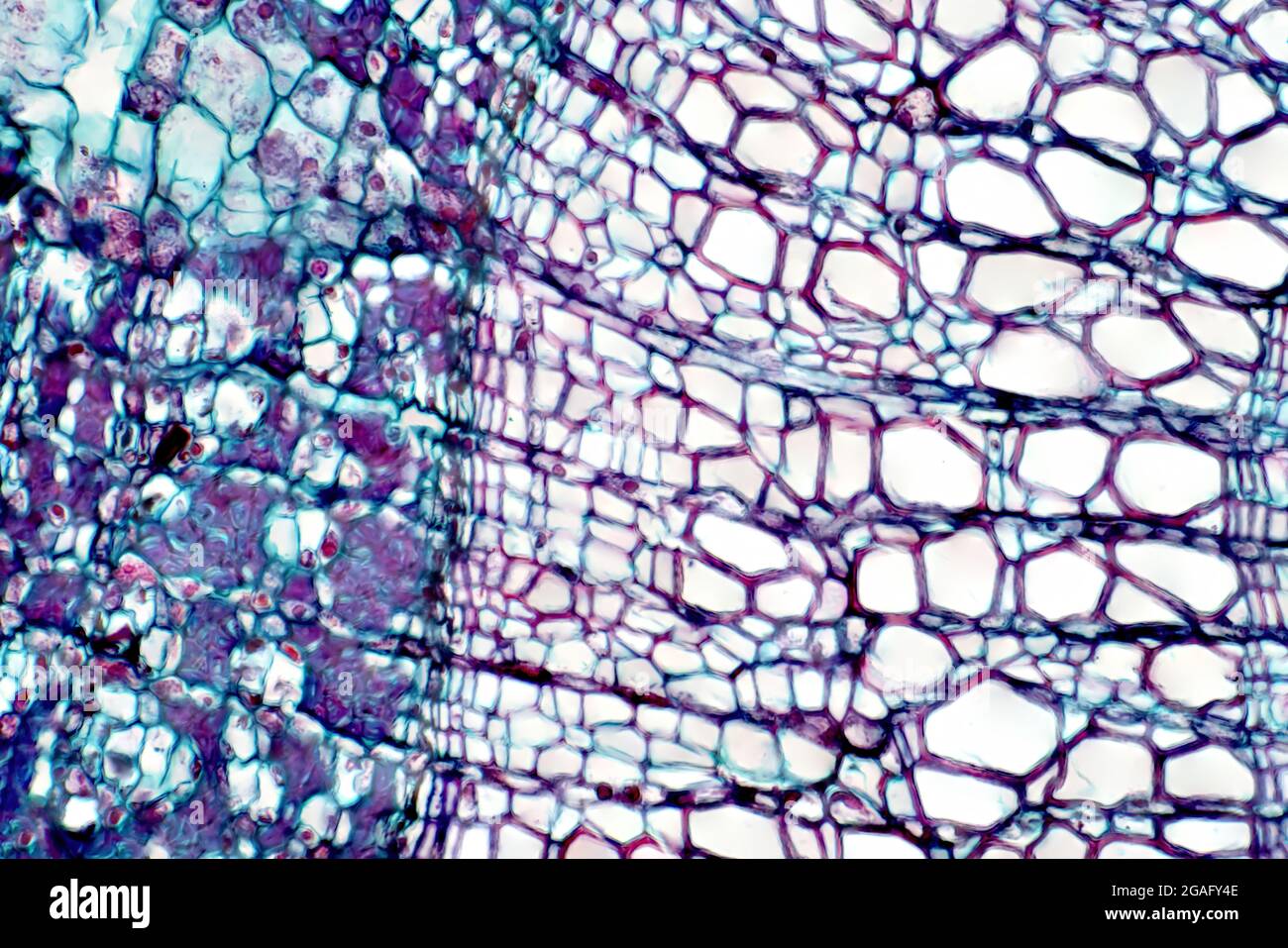 Xylem micrograph hi-res stock photography and images - Alamy