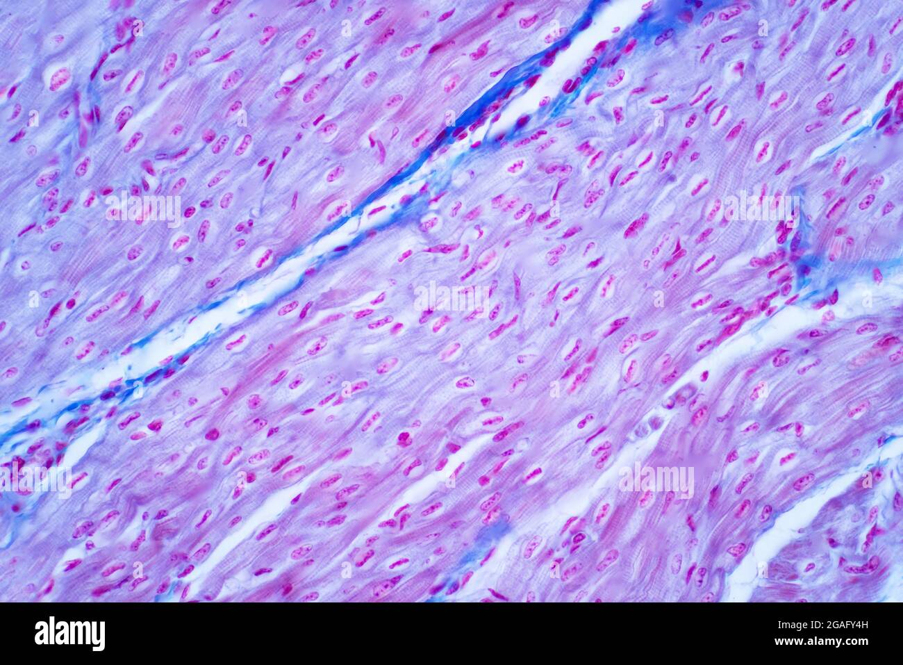 Cardiac muscle micrograph hi-res stock photography and images - Alamy
