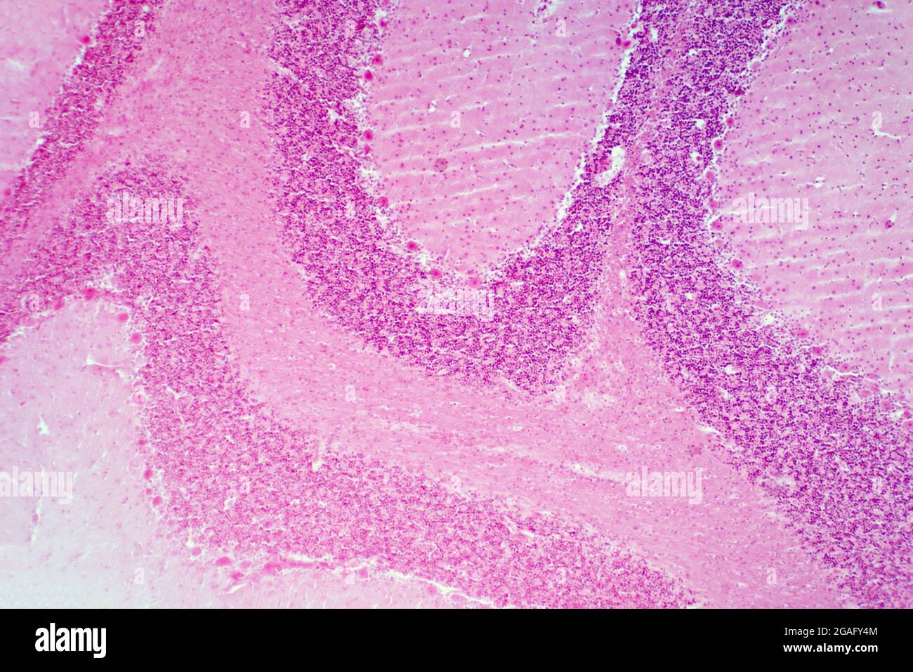 Cerebellum tissue, light micrograph Stock Photo - Alamy