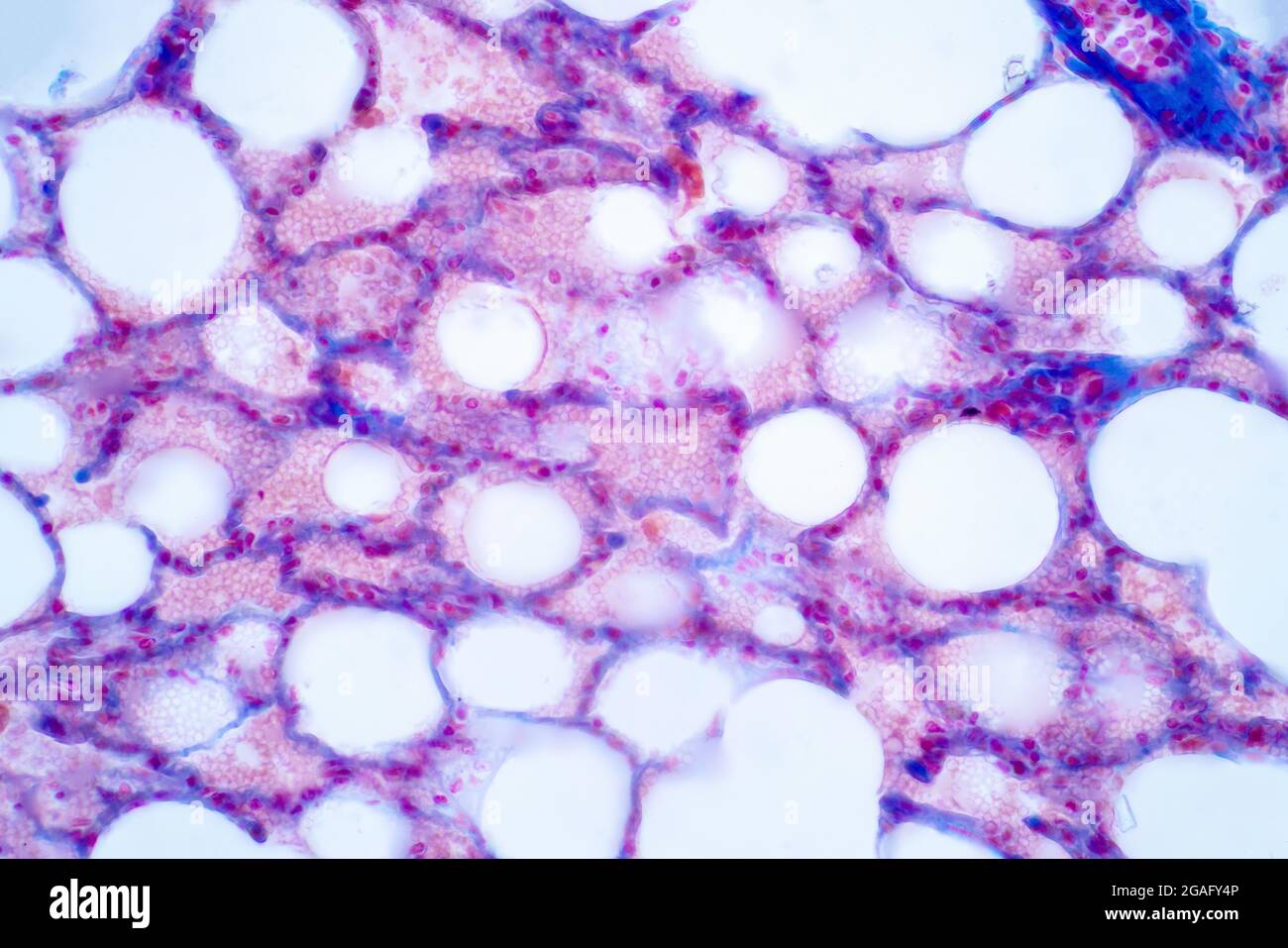 Human lung tissue, light micrograph Stock Photo - Alamy