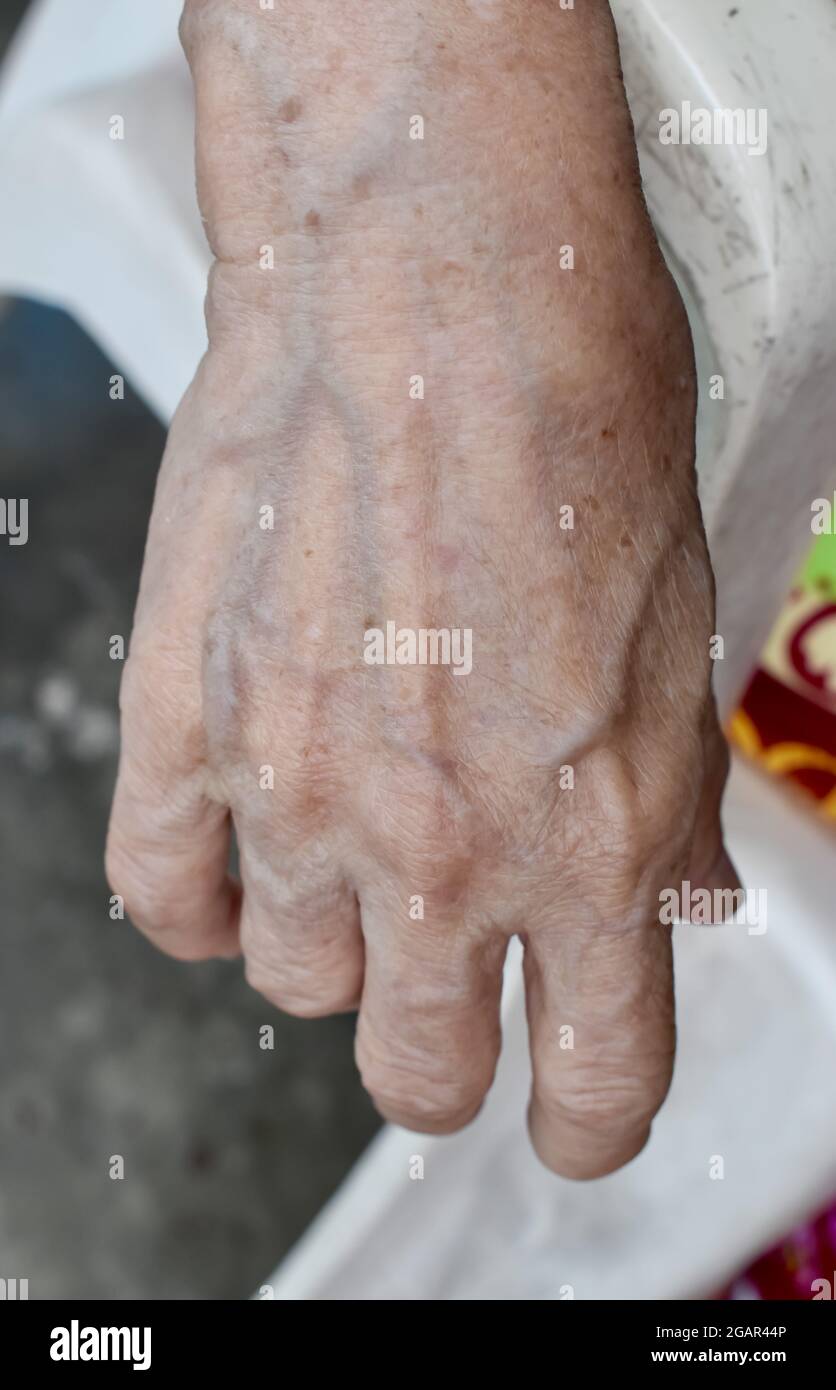 Southeast Asian, Myanmar old woman’s hand. Skin creases, loosen skin ...